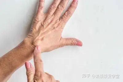 带你读懂结节性筋膜炎 知乎
