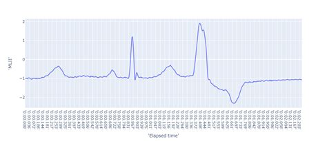 Pvc In Ecg Signal Object Detection Dataset V5 2022 12 18 11 47am By