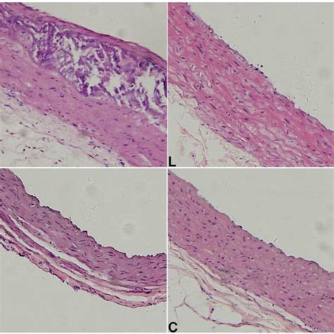 Interaction Between Enos And Caveolin 1 In Aorta Wall Protein Lysates