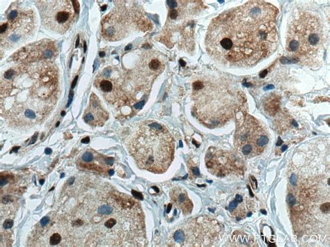 Sumo23 Antibody 67154 1 Ig Proteintech