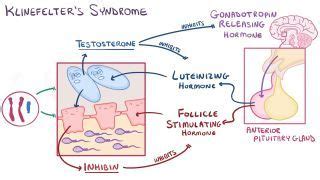 Sex Chromosome Disorders Notes Diagrams Illustrations Osmosis