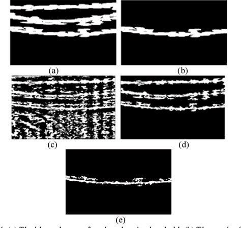 Figure 1 From A Computer Aided Method For Automatic Localization And