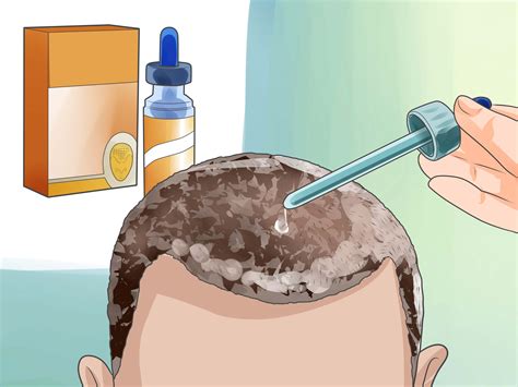 3 Ways To Hide Baldness WikiHow 3 Ways To Hide Baldness WikiHow