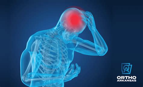 Keep Your Head In The Game How To Spot A Concussion Orthoarkansas