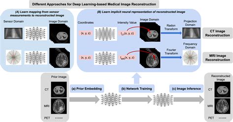 Nerp Implicit Neural Representation Learning With Prior Embedding For Sparsely Sampled Image
