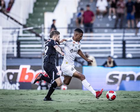 Atuações Do Santos Veja Quem Foi Bem E Quem Foi Mal Na Derrota Para O