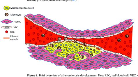 Brief Overview Of Atherosclerosis Development Key Rbc Red Blood