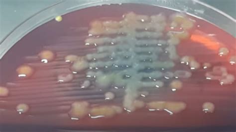K Pneumoniae Introduction Morphology Pathogenicity Lab