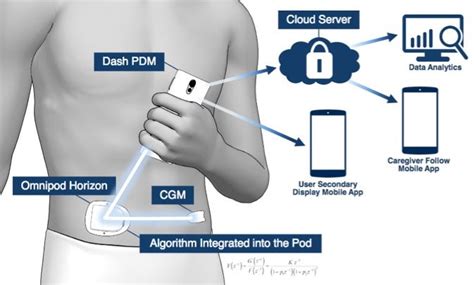 Does The Omnipod Closed Loop System Exist Yet Rdiabetes