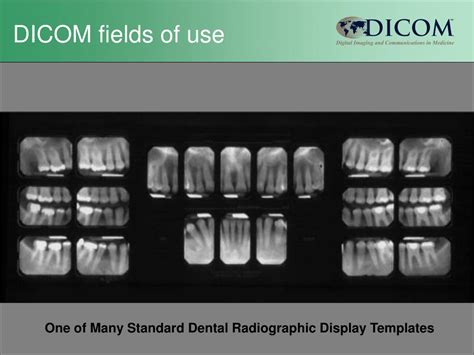 Ppt Dicom Fields Of Use Powerpoint Presentation Free Download Id