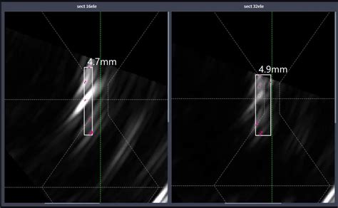 The Tip Diffraction Sizing Technique Provides Accurate Sizing Results Even… Autoscan Ai