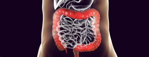 Virtual Colonoscopy Conditions And Treatments Ucsf Health
