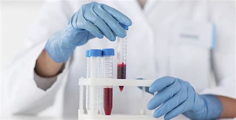 Nutritional Lab Tests In Ibd Nutrition 4 Ibd