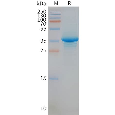 Human Steap1 Full Length Protein Synthetic Nanodisc Dima Biotechnology
