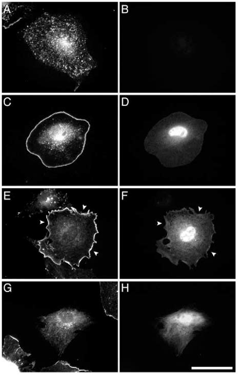 Activated Rac1 Stimulates The Translocation Of Cortactin To The Cell