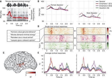 Amir Irandoust On Linkedin Intonational Speech Prosody Encoding In The Human Auditory Cortex