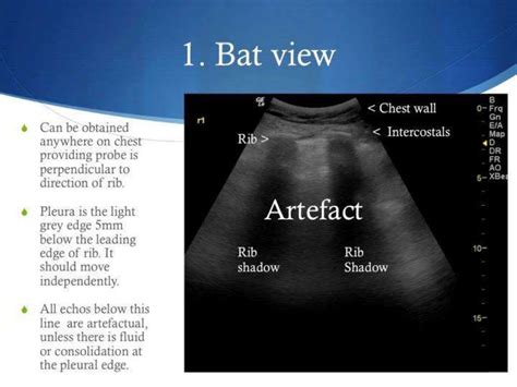 Signs In Lung Ultrasound