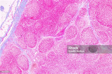 Histological Tonsil And Parotid Human Cells Under Microscope Stock