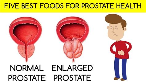 Five Best Foods For Prostate Health Youtube