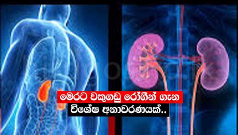 මෙරට වකුගඩු රෝගීන් ගැන විශේෂ අනාවරණයක් News Artical Hiru Gossip Lanka Gossip Hirugossip