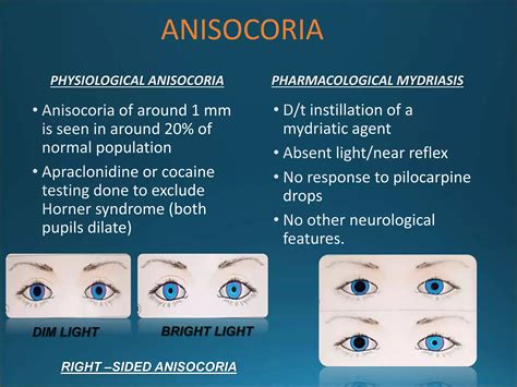 734 Visual Pathway Lesions Pptx