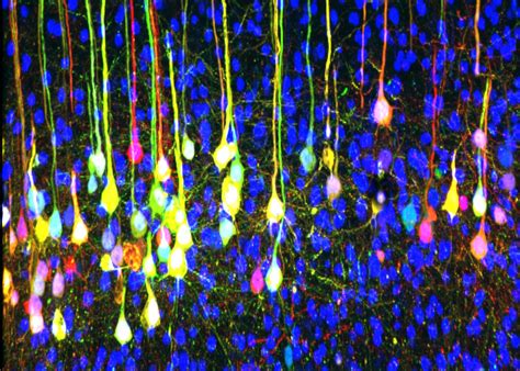 Neuron Tracing Image Eurekalert Science News Releases