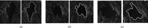 Accurately Identified Intermediate Size Potholes Over Different Download Scientific Diagram