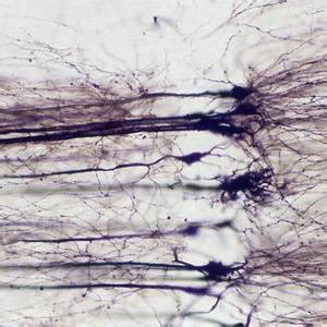 Nerve Cells And Glial Cells Sem Photograph By Thomas Deerinck Ncmir Fine Art America