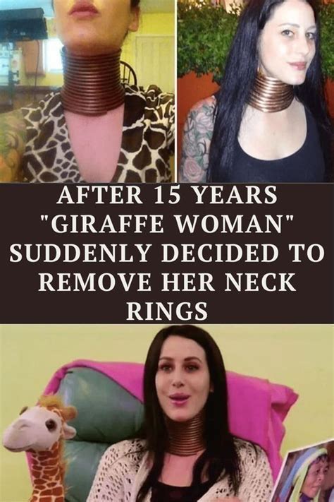 After 15 Years Giraffe Woman Suddenly Decided To Remove Her Neck Rings