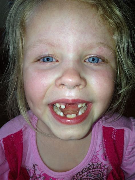 Welcome To The Krazy Kingdom Toothless Yet Again More