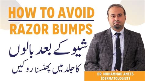 How To Avoid Prevent Razor Bumps Shave Ke Bad Pimples Treatment For