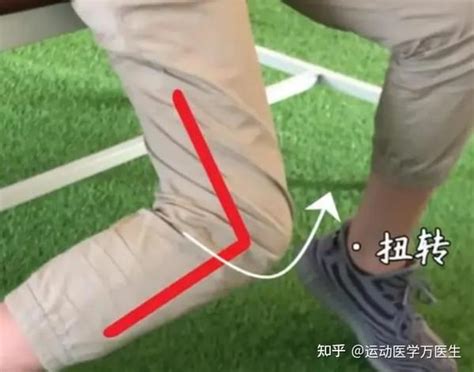 内侧副韧带损伤——最容易保守治疗痊愈的韧带伤 知乎