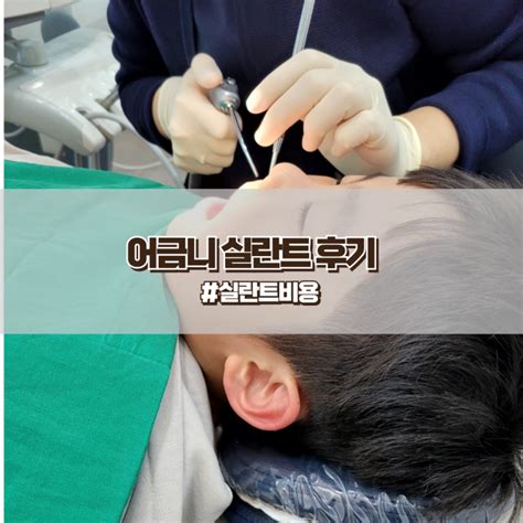 유치 영구치 어금니 실란트 후기 치과 보험 비용 네이버 블로그