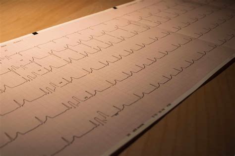 Ecg Vs Ekg Whats The Difference