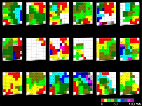 Activation Maps During Permanent Atrial Fibrillation Eighteen