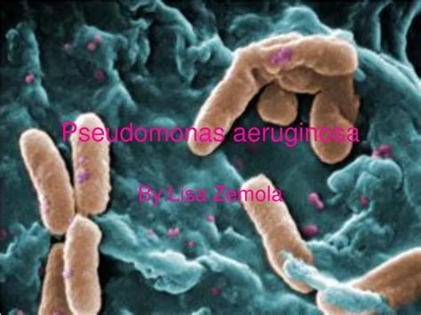 Ppt Pseudomonas Aeruginosa Powerpoint Presentation Free Download