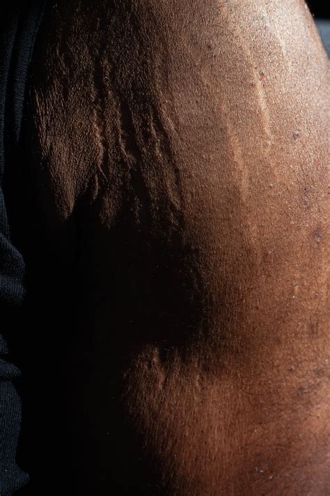 Let The Real Stretch Marks Rip Grandfather Clocks Blog