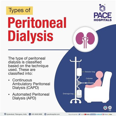 Peritoneal Dialysis Catheter Types