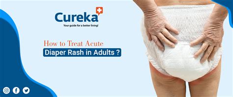 Diaper Rash Adult