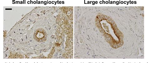 Figure 2 From Calcium Signaling And Secretion In Cholangiocytes