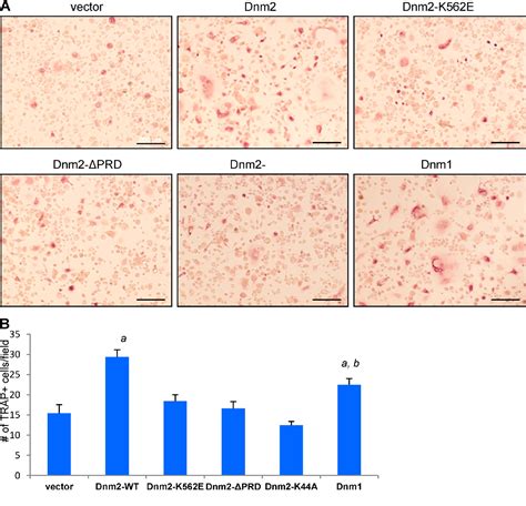 Figure 4 From Dynamin And Endocytosis Are Required For The Fusion Of