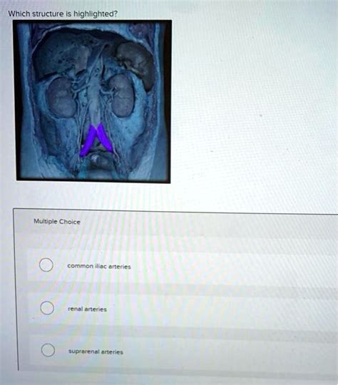Solved Which Structure Is Highlighted Multiple Choice Common Iliac