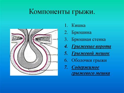 Ущемленная паховая грыжа - online presentation