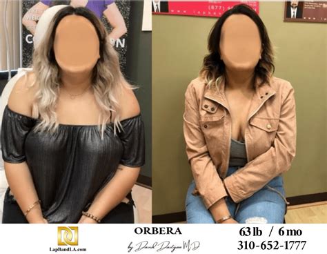Gastric Balloon Weight Loss Doctor In Los Angeles Lap Band Los Angeles