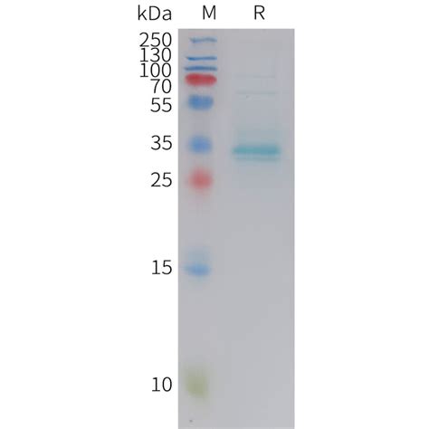 Human Parathyroid Hormone Protein Fc Tag A325045