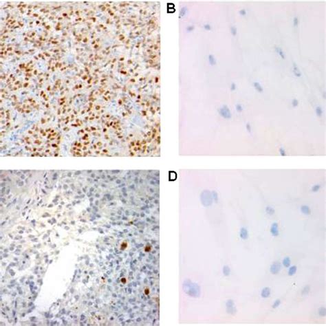 Immunostaining Of Erα A And B And Erβ C And D In Spn Tissue Left