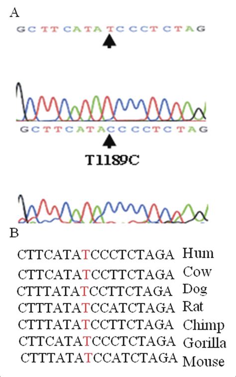 Mtdna Mutations Hearing Loss And Aminoglycoside Treatment In Mexicans Brazilian Journal Of