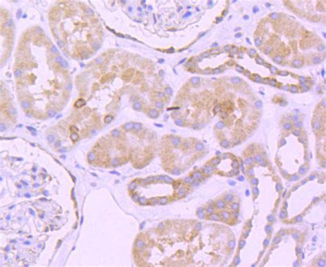 Bcl 2 Rabbit Mab Sab Signalway Antibody