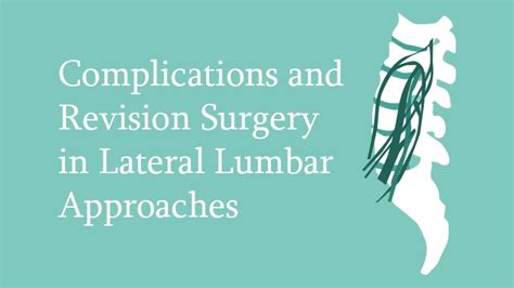 Lateral Lumbar Approaches Spine Surgery Complications And Revisions