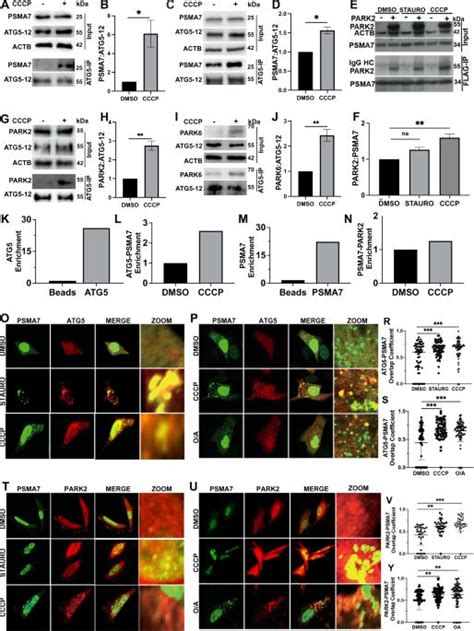 Nur Kocaturk Phd On Linkedin Novel Protein Complexes Containing Autophagy And Ups Components